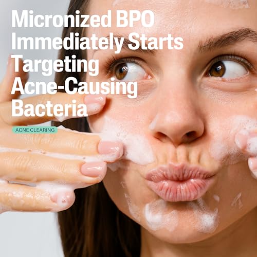Cetaphil Gentle Clear Complexion-Clearing BPO Acne Cleanser with 2.6% ...